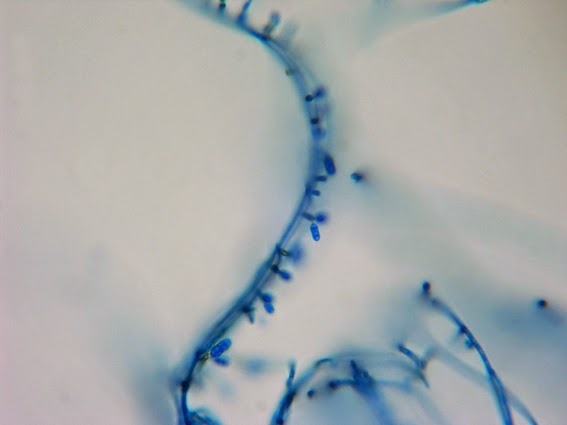 Fun With Microbiology (What's Buggin' You?): Ochroconis species