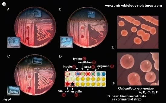 Doctor Wanna Be: laporan praktikum mikrobiologi enterobacteriaceae