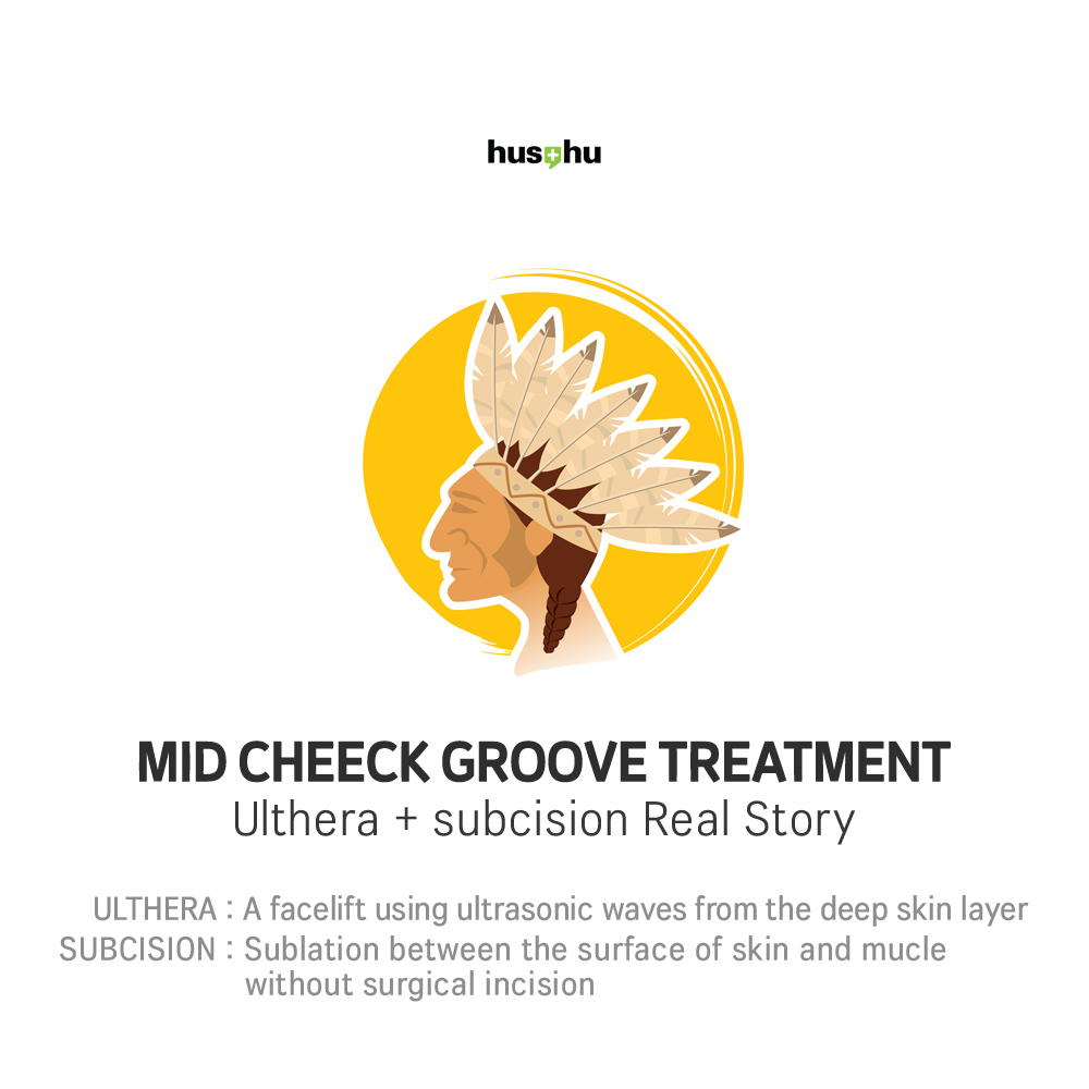 Hushu Dermatology: Mid Cheek Groove treatment-Real Story