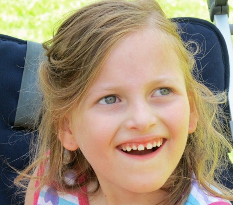 Sindrome de Angelman