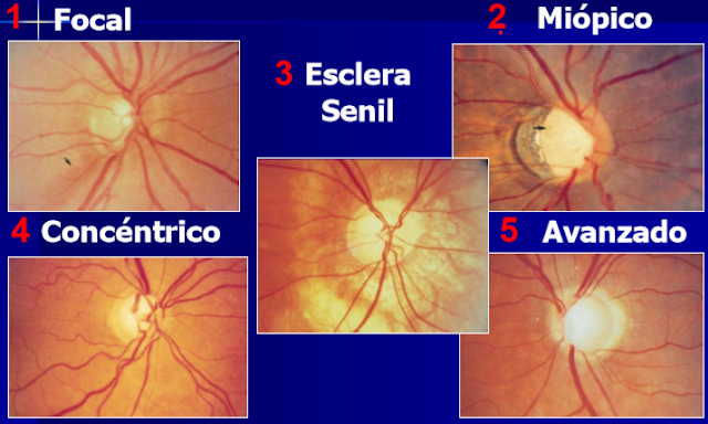 Cátedra N° 06 - Exámenes y programas