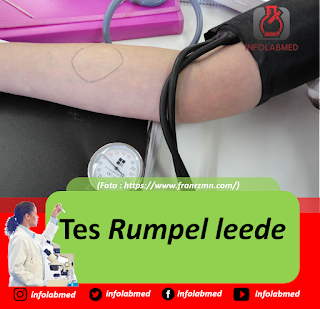 Tes Rumpel leede