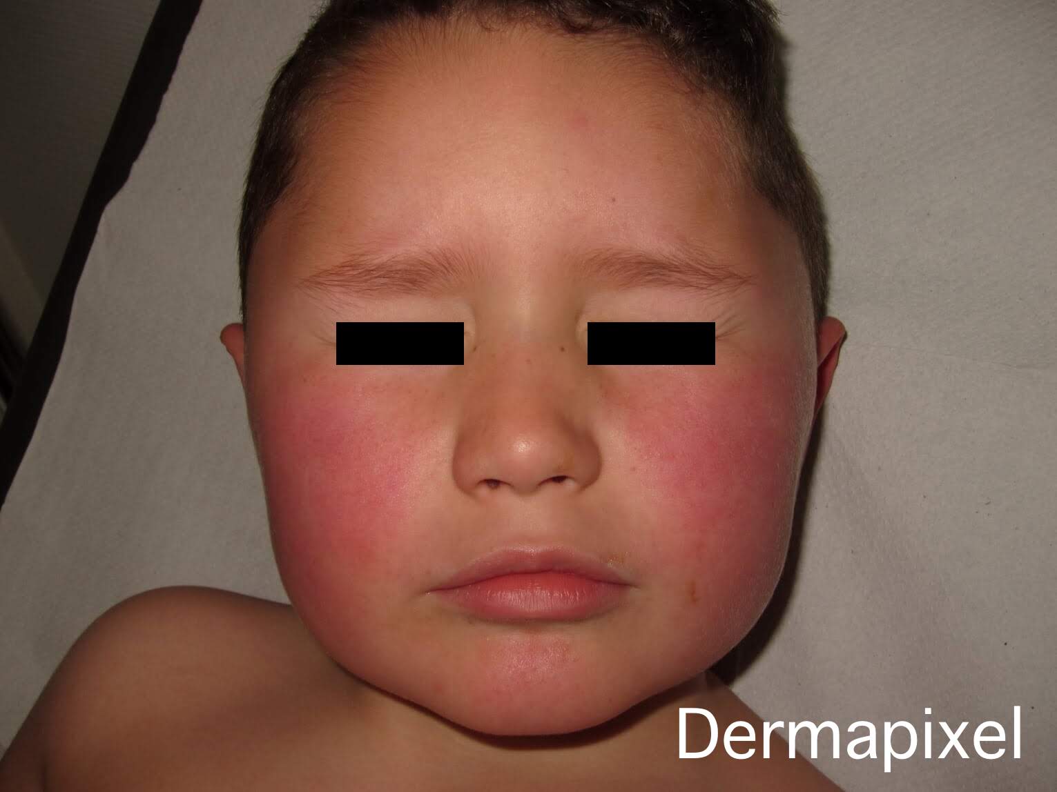 Dermapixel: marzo 2020