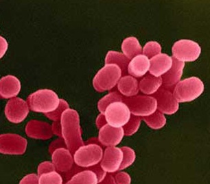 Food Borne Disease: Brucella spp