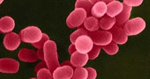 Food Borne Disease: Brucella spp