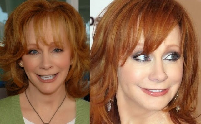 Reba McEntire Plastic Surgery