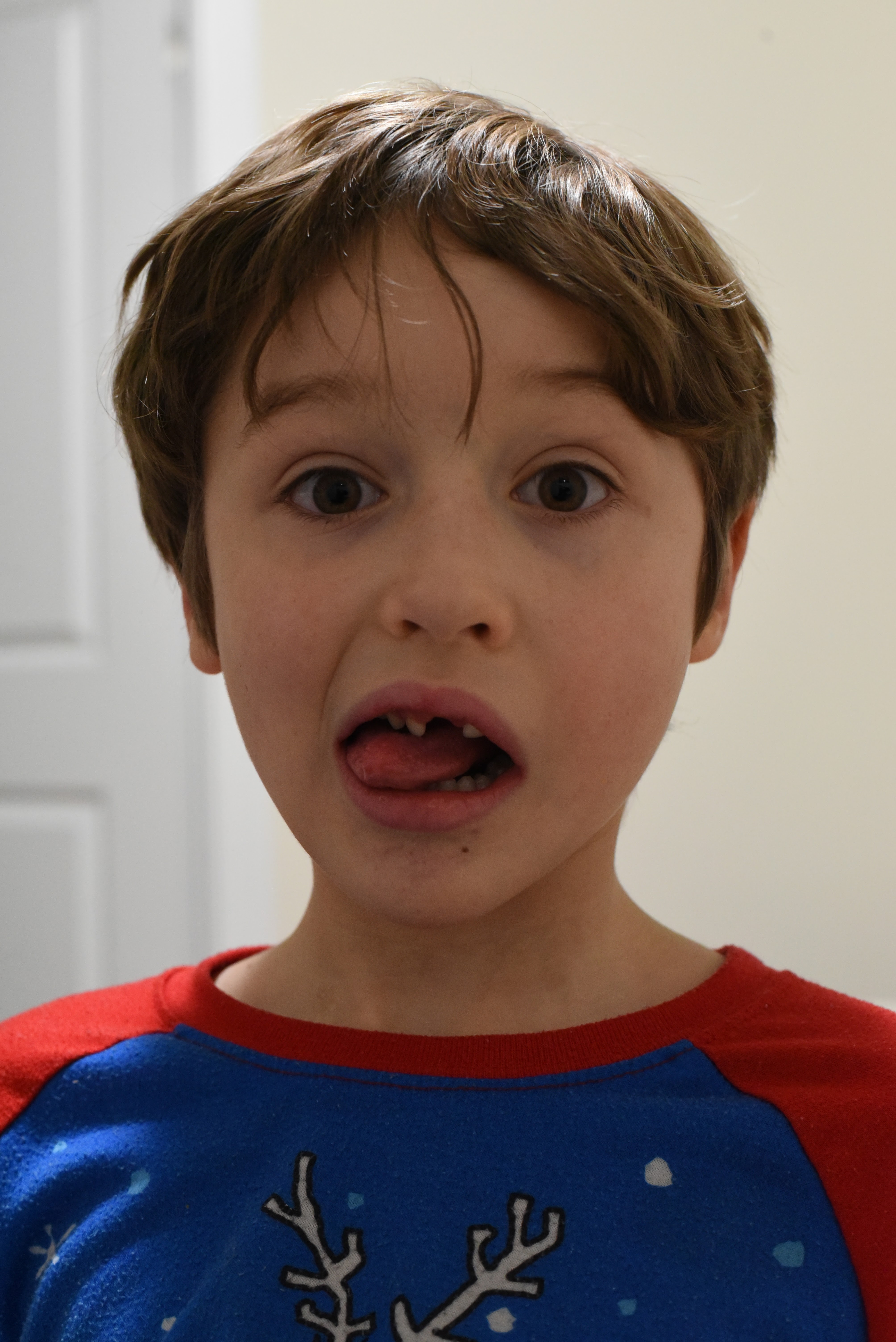 The Wilkins: Leif Loses His First Tooth