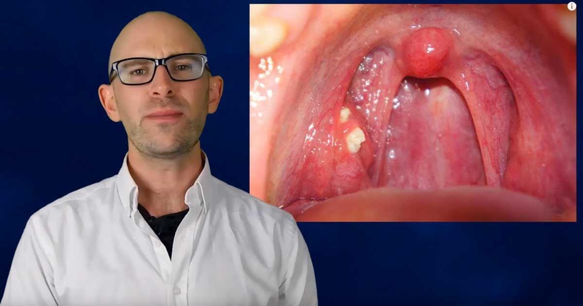 Gárgaras: un remedio que funciona para aliviar el dolor de garganta ...