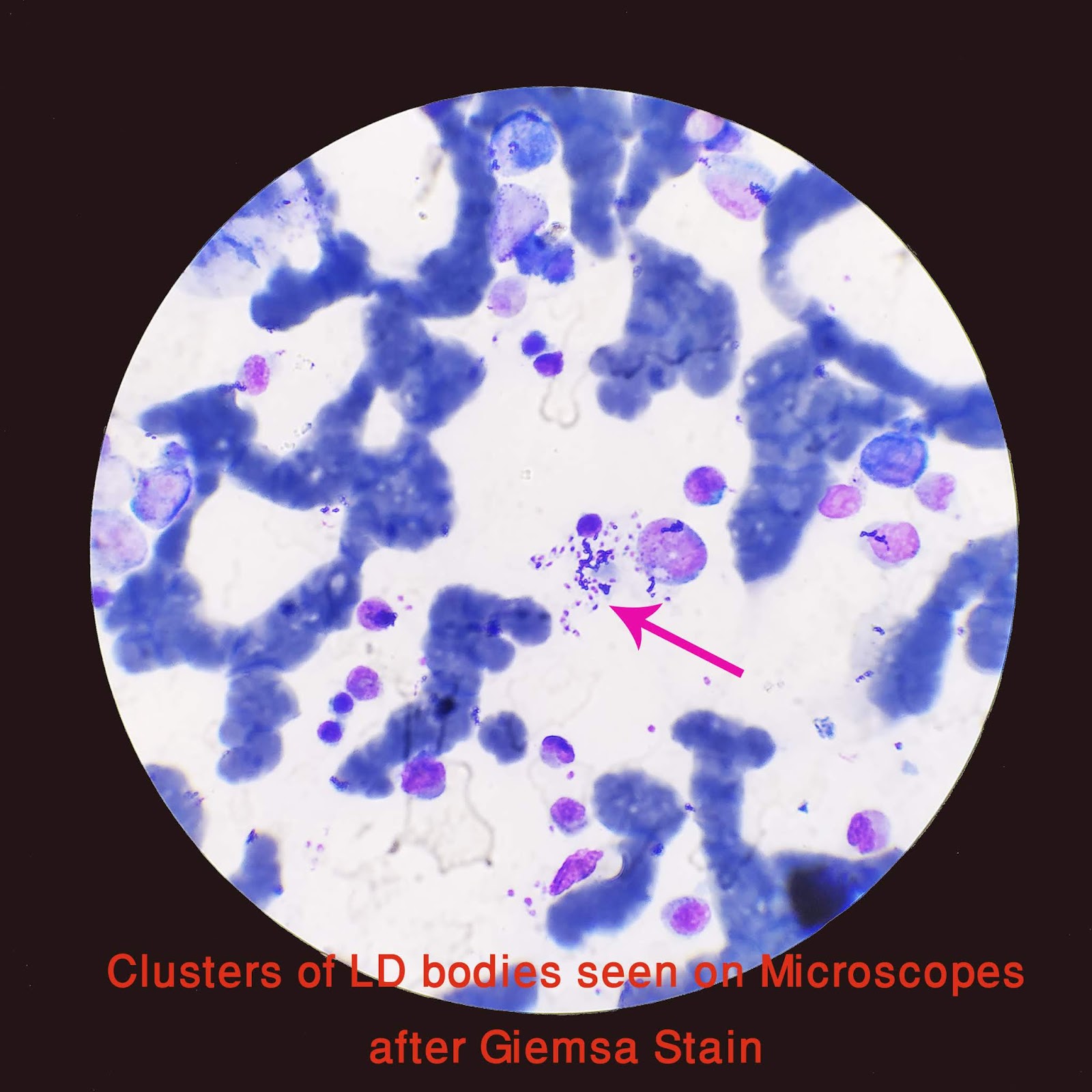 MICROBIOLOGY BLOG FOR STUDENTS (MBLOGSTU): Leishmania donovani bodies ...