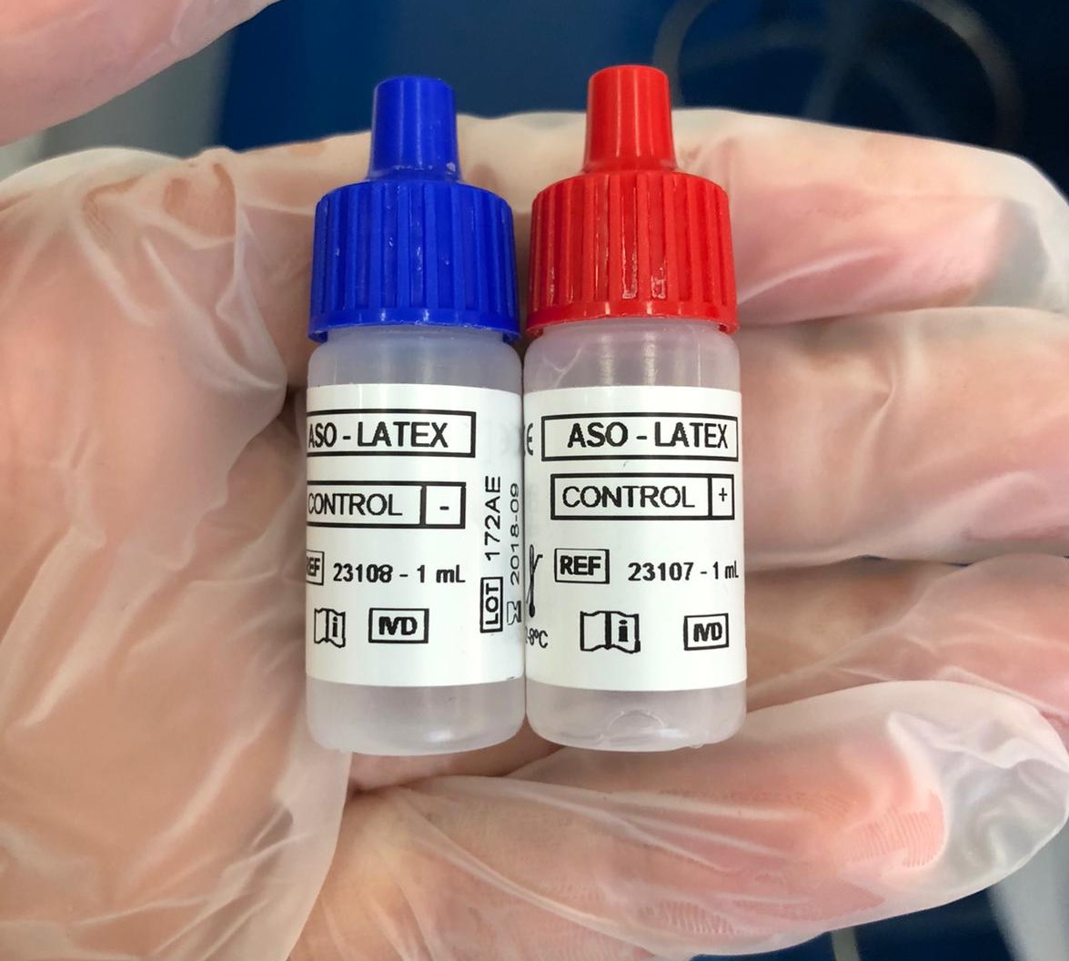 Práctica 4. ASO-Latex. Aglutinación en tarjeta 15/10/2019