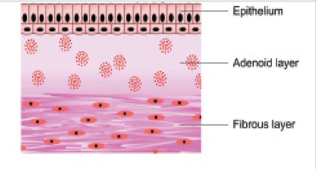Anatomy of Conjunctiva - bulbar, palpebral,tarsal, fornix conjunctiva ...