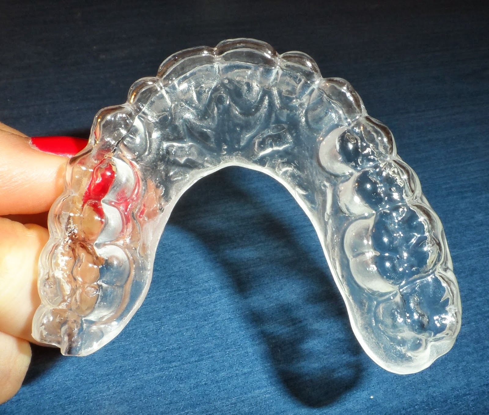 Orto druciki: Retainer