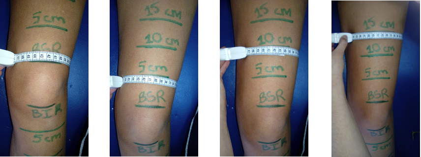 FisioEstudantes: Perimetria