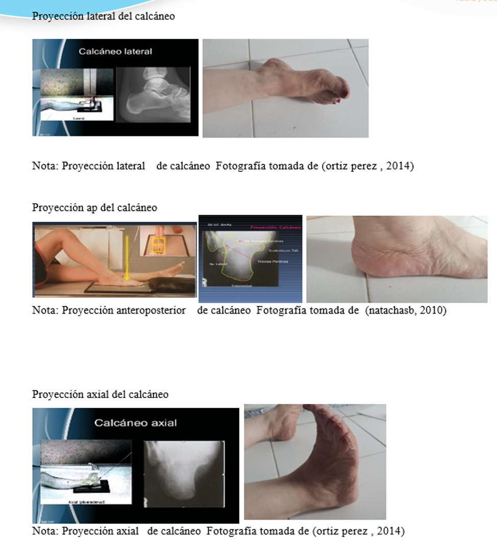 CREACION DE PROTOCOLOS : ESTUDIOS RADIOGRAFICOS MIEMBROS INFERIORES