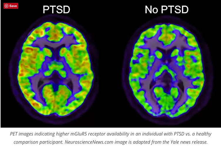 Wounded Times: PTSD, Hear It To See It