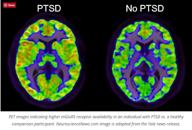 Wounded Times: PTSD, Hear It To See It