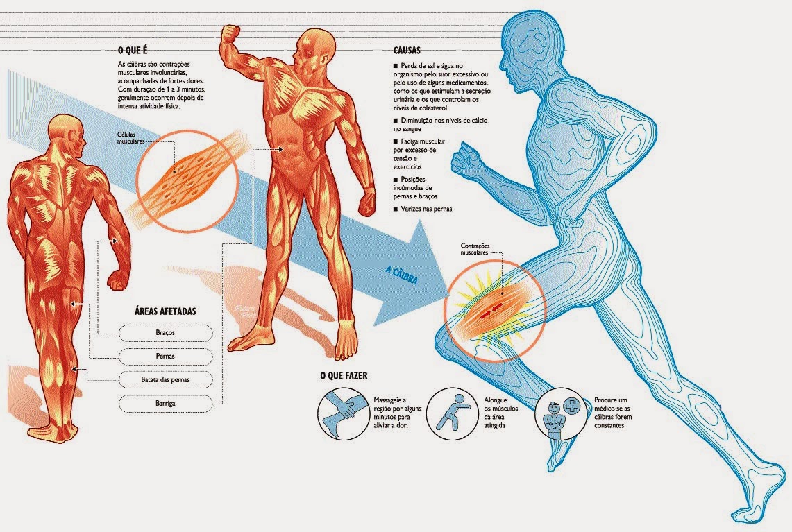 DICA: Câimbras ~ Dra Marlene Costa