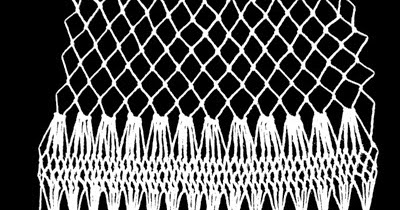 Knots Indeed: Netted Edging from Tatting and Netting