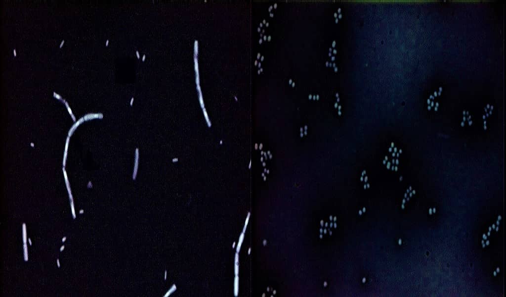 Negative Stains and Capsule Stains - Microbiology Laboratory Turkey