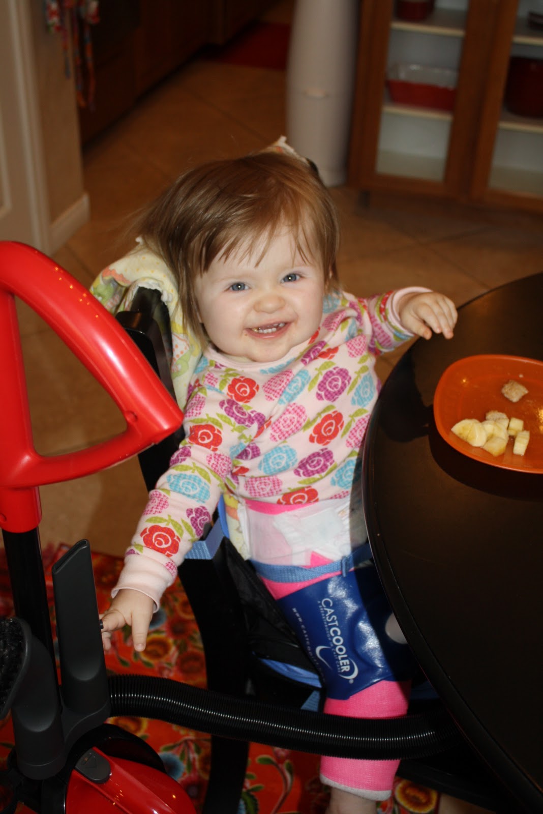 one hip blog: Spica Cast info & Tips