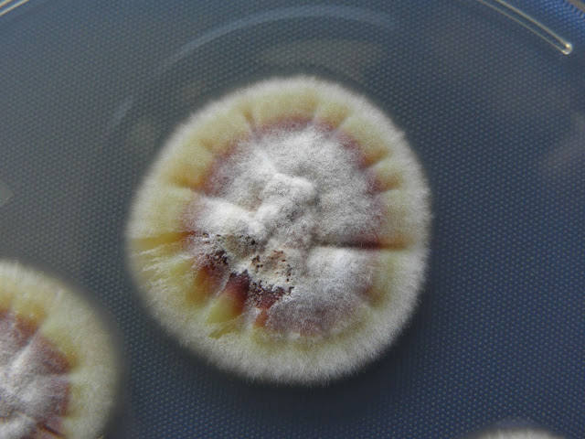 ATLAS MICOLOGIA: TRICHOPHYTON RUBRUM - COLÓNIA COM 13 DIAS DE INCUBAÇAÕ