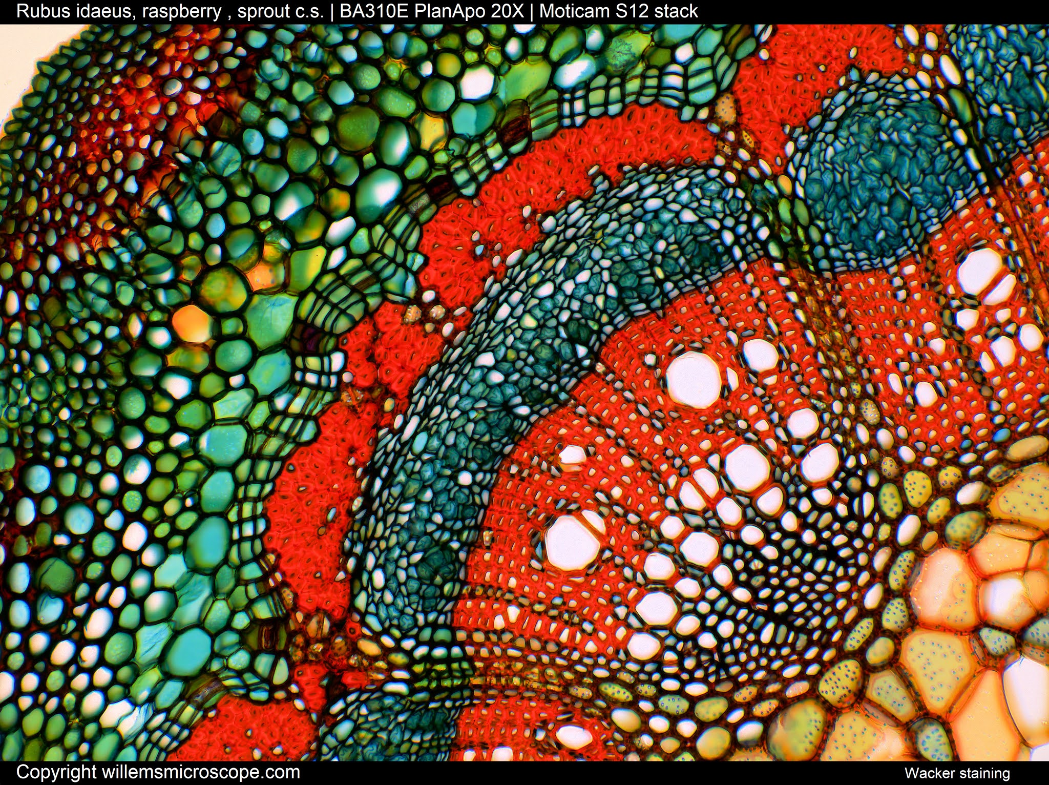 Motic Europe | Blog: Triple Stain Wacker 3A