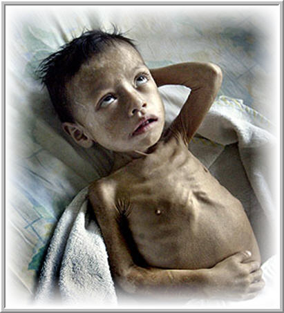 S T R A V A G A N Z A: STARVATION AND ITS EFFECTS ON THE BODY