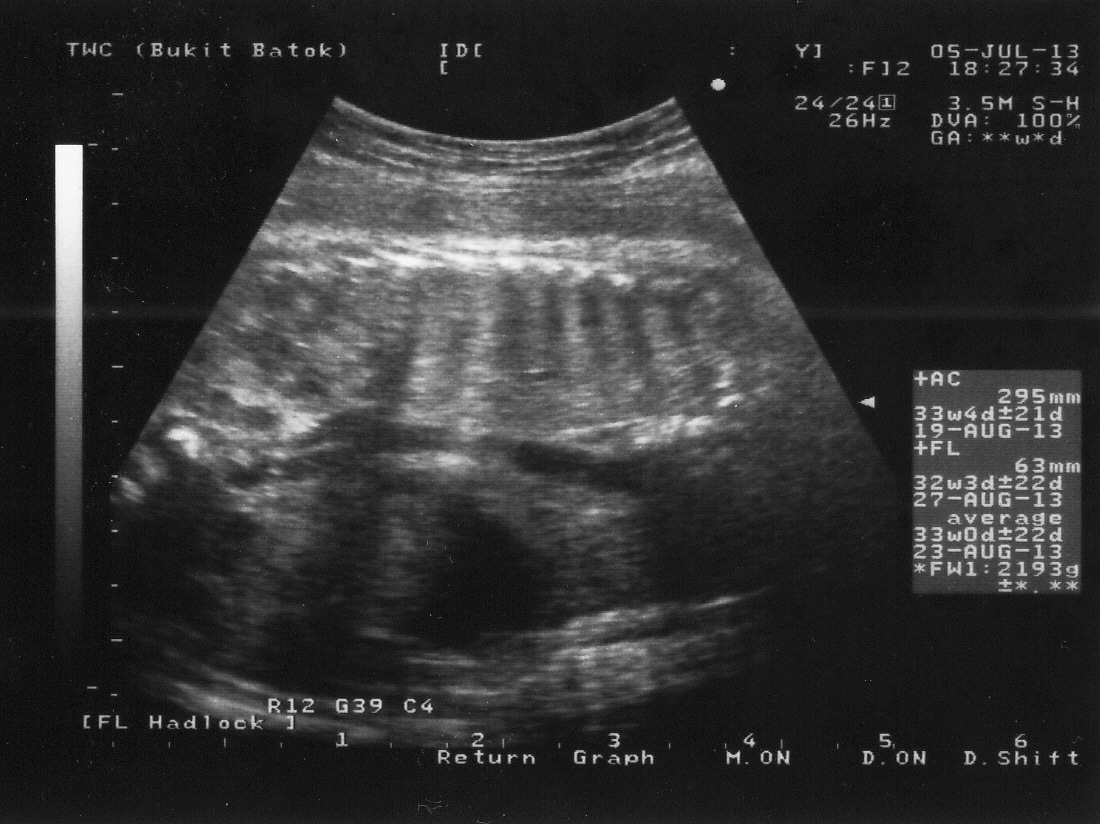 The Joyful Nine Months: Week 34 - Baby's development