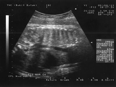 The Joyful Nine Months: Week 34 - Baby's development