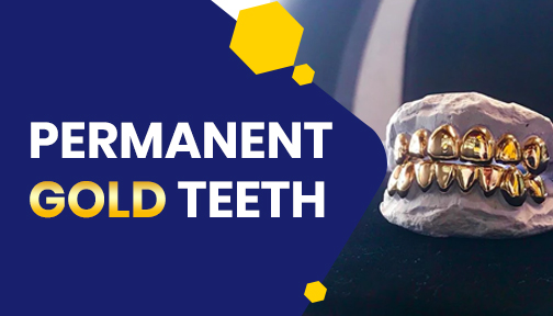 Harris Park Dental Lab in Australia: Permanent Gold Teeth Cost ...