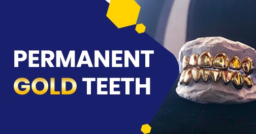 Harris Park Dental Lab in Australia: Permanent Gold Teeth Cost ...