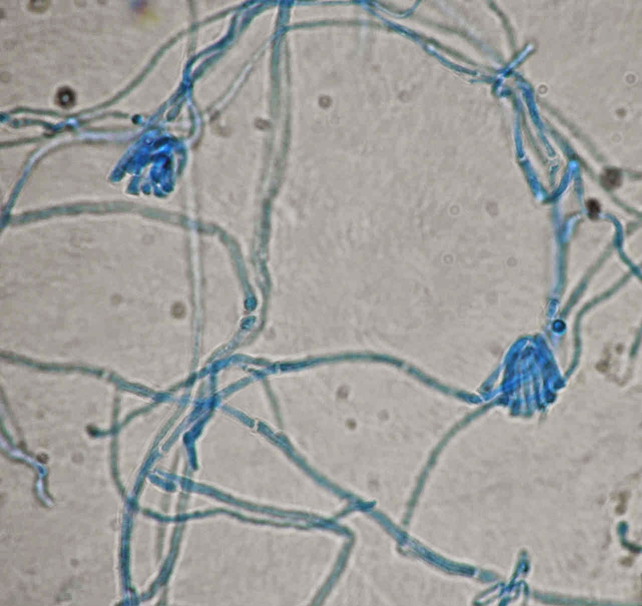 ATLAS MICOLOGIA: TRICHOPHYTON INTERDIGITALE VARIEDADE NODULAR