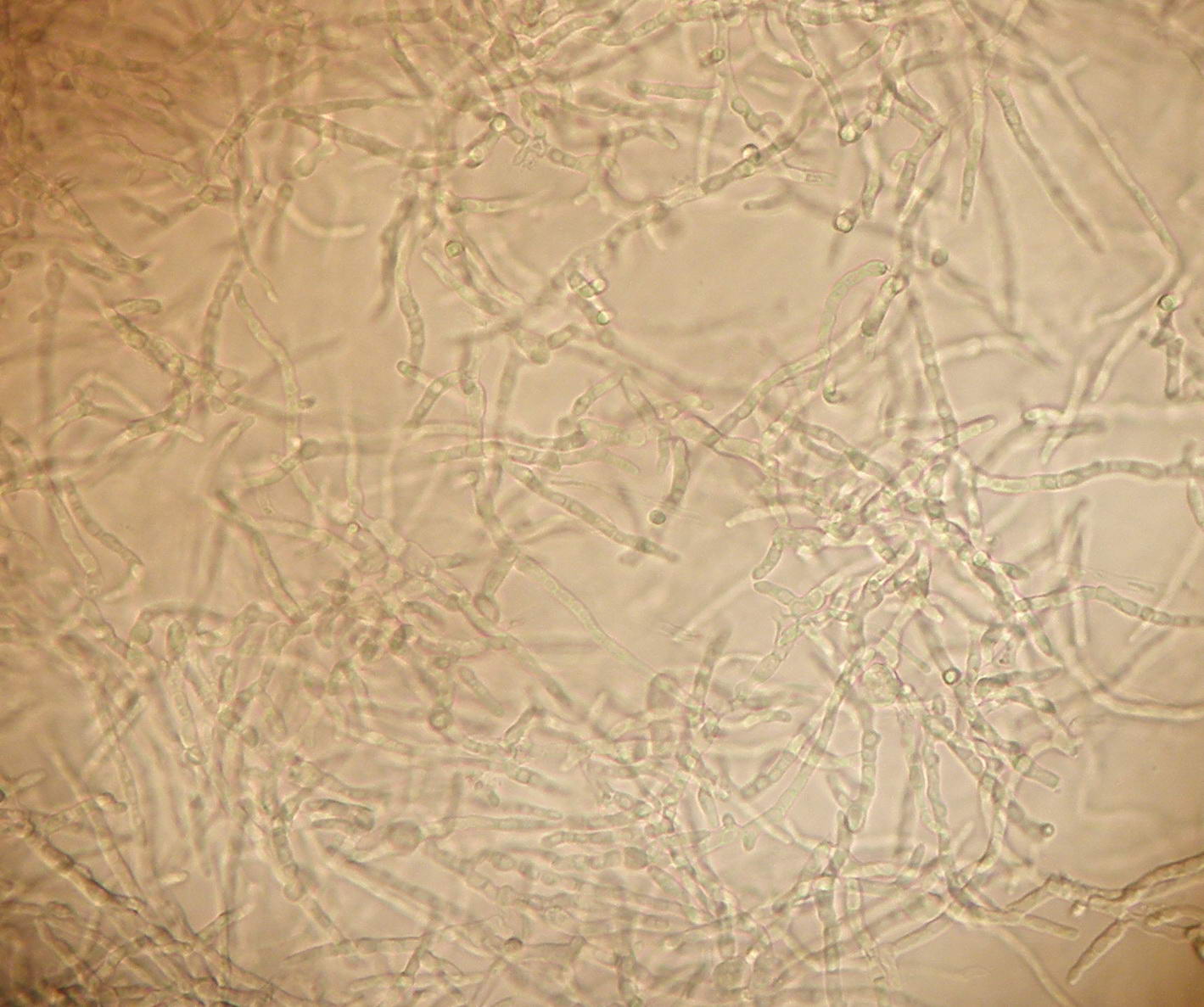 ATLAS MICOLOGIA: TRICHOPHYTON VIOLACEUM