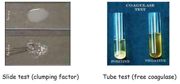 Coagulase Test: Slide and Tube Method | Laboratory Stack
