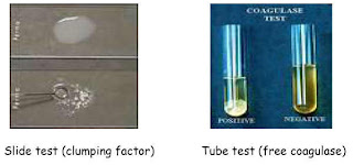 Coagulase Test: Slide and Tube Method | Laboratory Stack