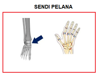Bentuk Sendi pada Tubuh Manusia ~ Kelas Bu Asih