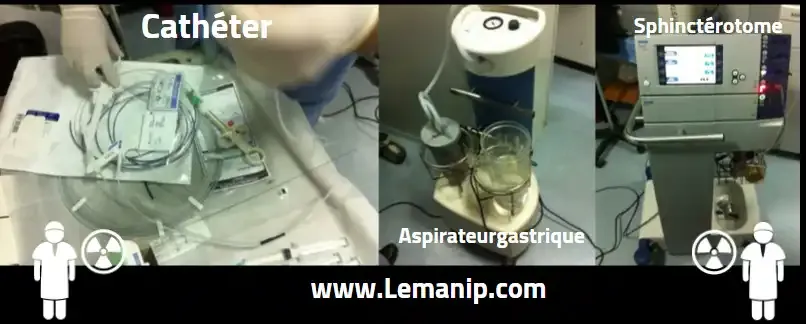 CholangioPancréatographie Rétrograde Endoscopique CPRE