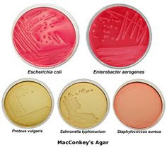 Media Mac Conkey Agar (MCA) ~ Medical Laboratory Technologist