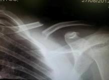 Umberto de Oliveira Nunes - Ortopedista e Traumatologista - TEOT 5529 ...