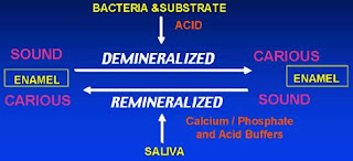 Dental Mnemonics: Cariogenic Bacteria