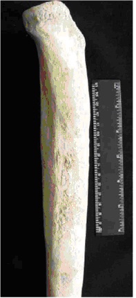 Paleopatología medieval: los enfermos de la Edad Media.: octubre 2015