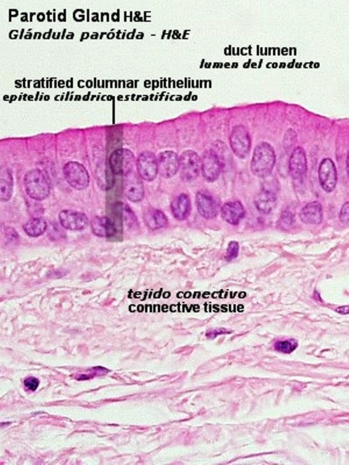 Plantão Médico: HISTOLOGÍA TEJIDO EPITELIAL DE REVESTIMIENTO Y GLANDULAR