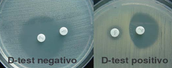 Bacterias Actuaciencia: 2020