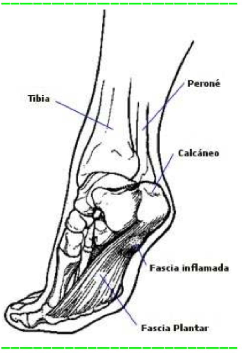 Vampiro Erudito: Calcáneo