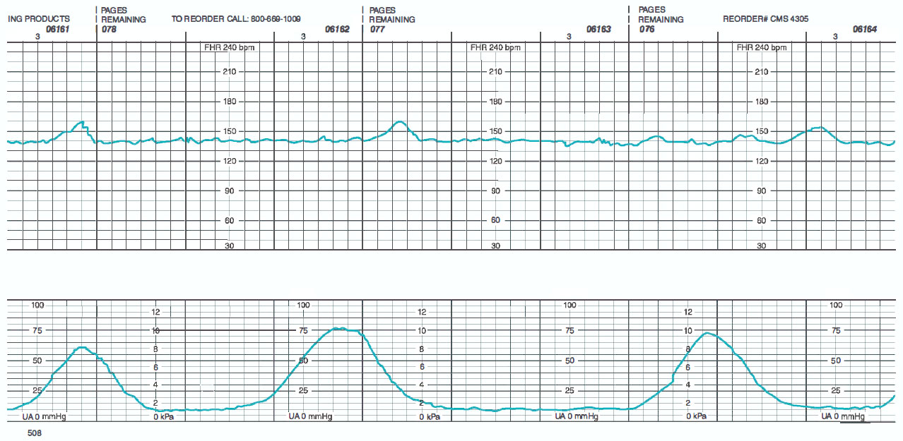 Labor and Delivery Case File