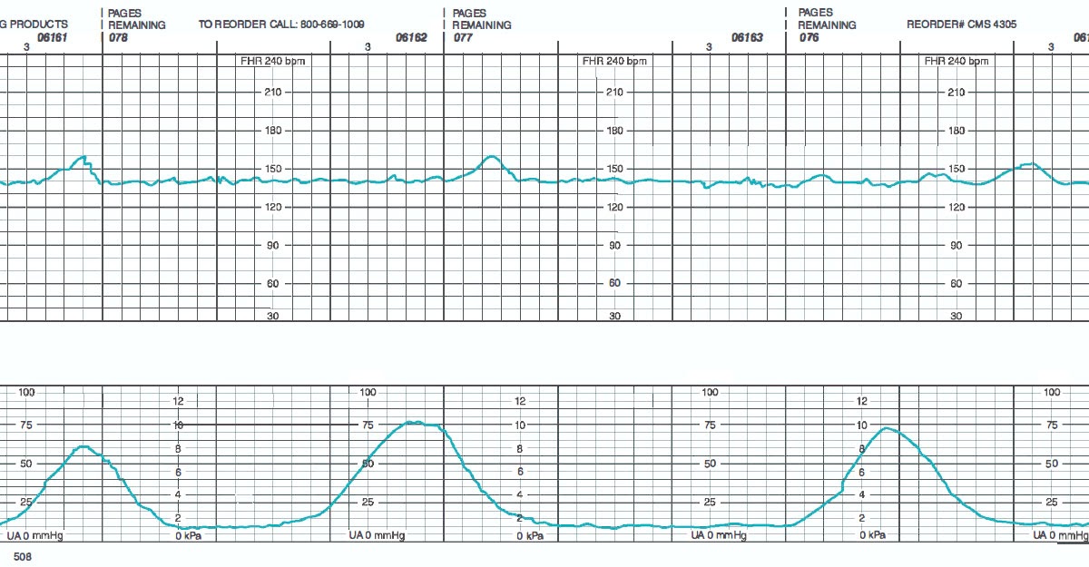 Labor and Delivery Case File