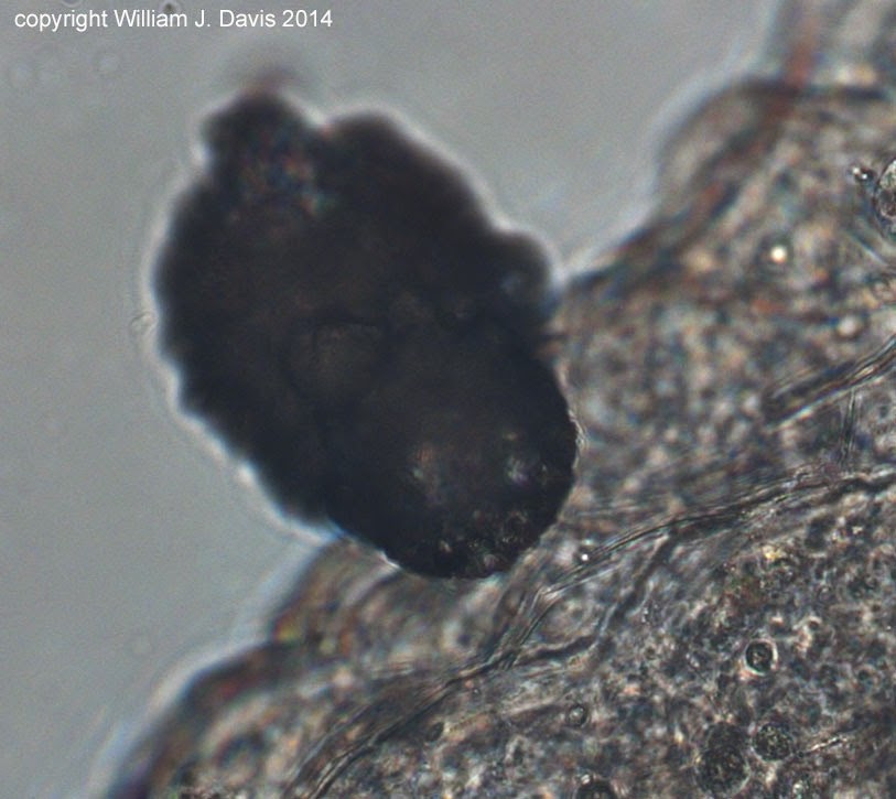 Wandering Naturalist: Protist Love 1--Difflugia!