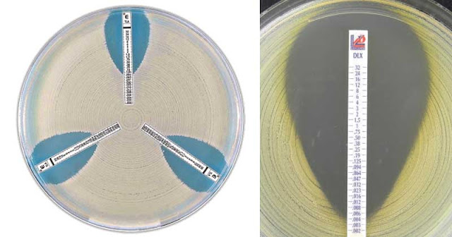 Epsilometer test (E-test): Metode Uji Modern dalam Menentukan ...