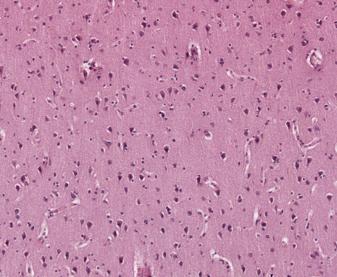 Cysticercosis - Hannah Vaught Histology Blog: Histology and Histopathology