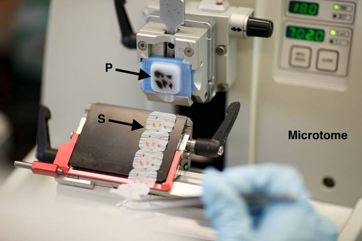 The Girl with the Lobster Tattoo: Lobster blood suckers and the wonders ...